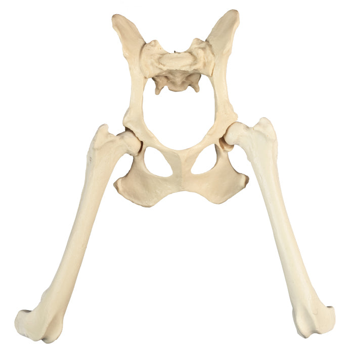 AV800ESP - FULL CANINE PELVIS WITH RIGHT AND LEFT FEMUR, CANC. MATERIA